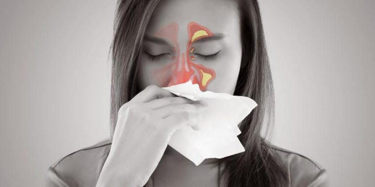 Los Mejores Medicamentos para Sinusitis * Guía Médica [2025 ]